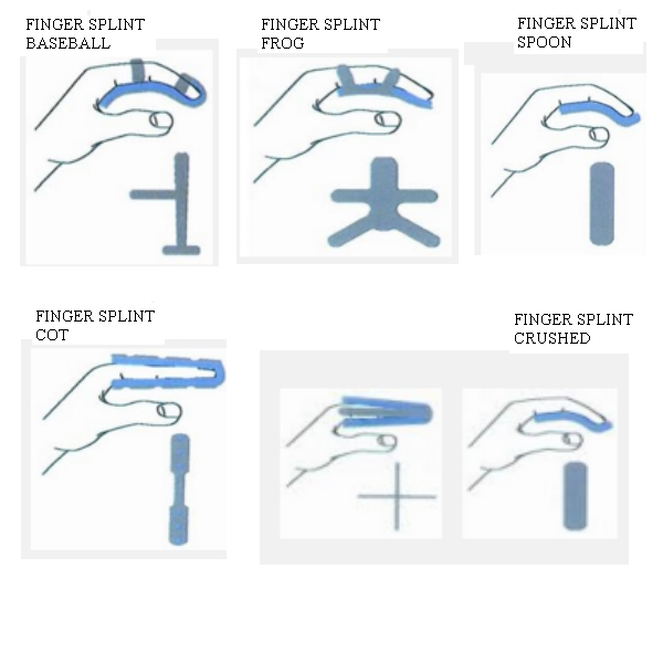 Finger Splint | Medical Cañada